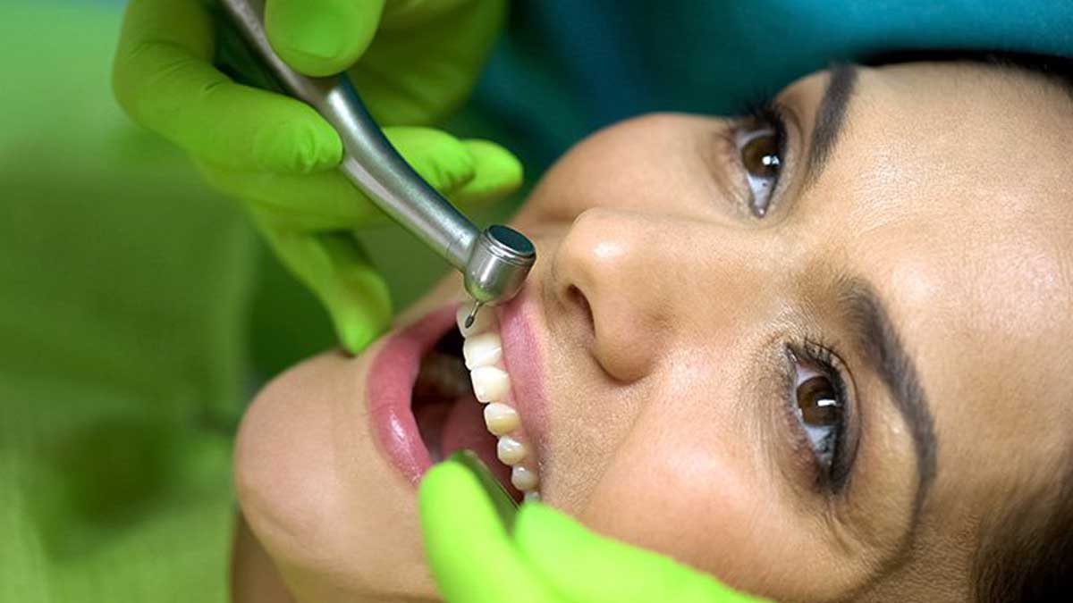 How Much to Fix a Broken Tooth Without Insurance - Mstwotoes
